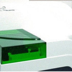 Sebia | CAPILLARYS IMMUNOTYPING | Electrophoresis