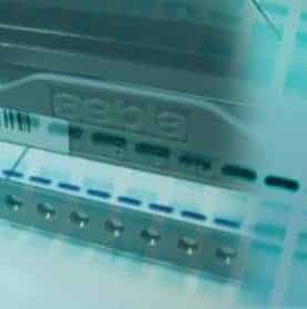 SEBIA | HYDRAGEL IF PENTA | Gel Electrophoresis | MSC