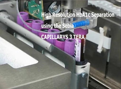 High Resolution HbA1c Seperation | Medical Supply Company