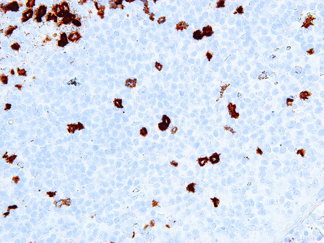 CD57 | Medical Supply Company