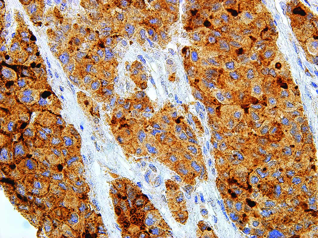 Glypican-3 | Medical Supply Company