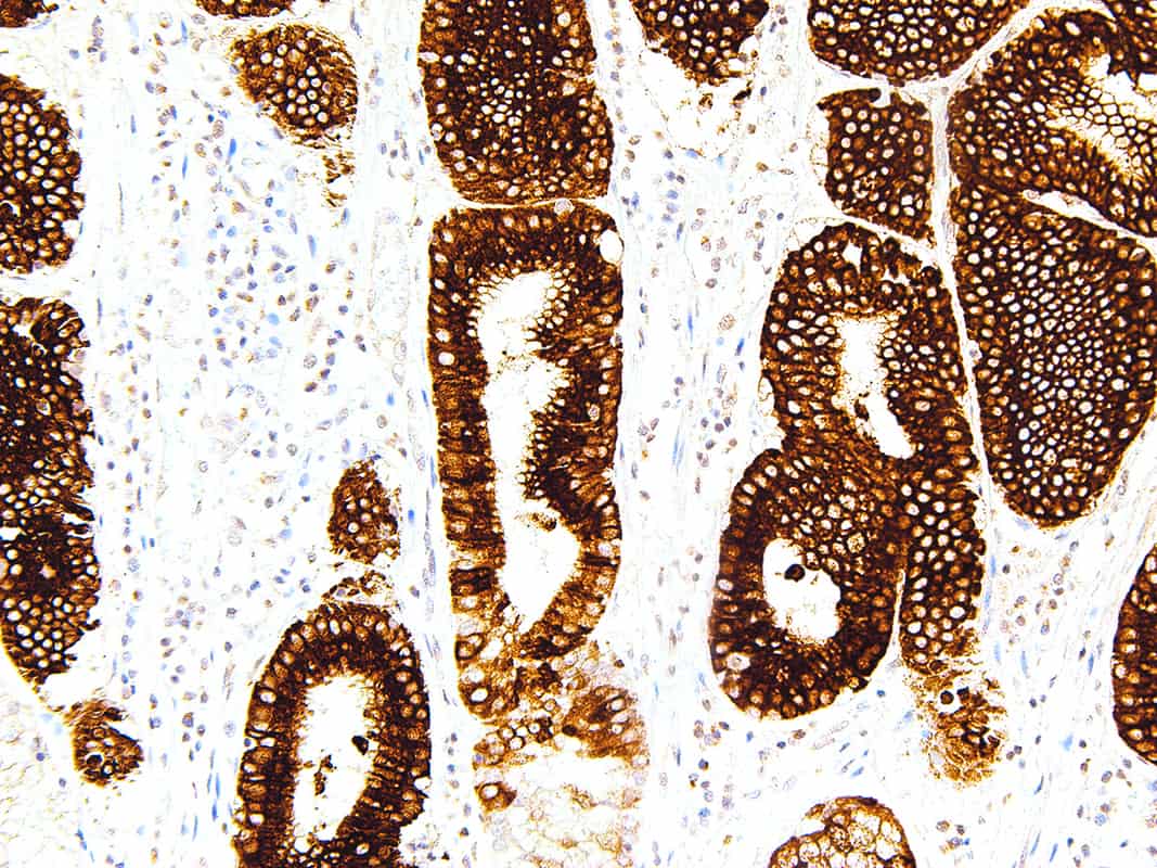 MUC5AC | Medical Supply Company