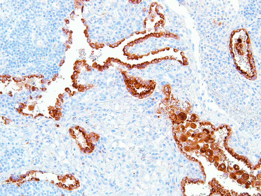 Napsin A | Medical Supply Company