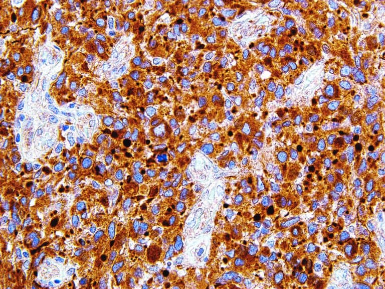 Neurofilament | Medical Supply Company