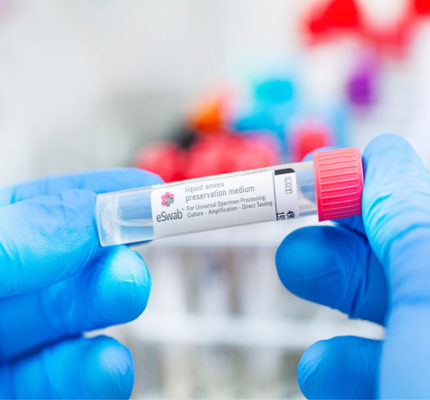 eSwab 1ml Liquid Amies Regular Flocked Swab White Cap | Medical Supply ...