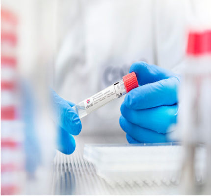 eSwab 1ml Liquid Amies with Regular Flock Swab for automation | Medical ...