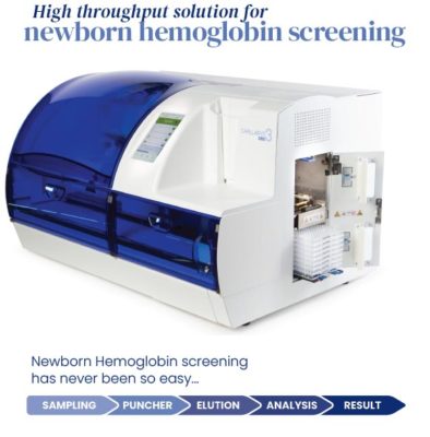 Why consider Sebia’s high throughput solution for newborn hemoglobin ...