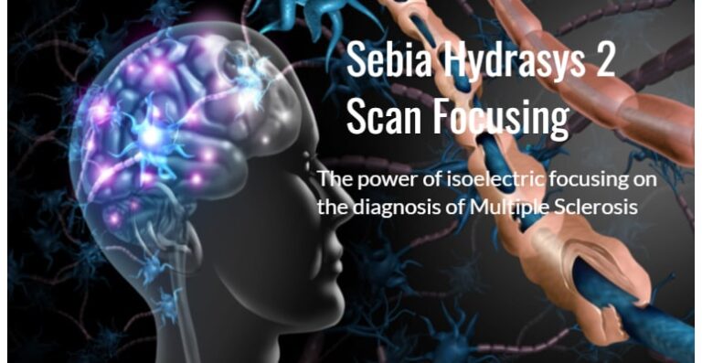 The power of isoelectric focusing on the diagnosis of Multiple ...