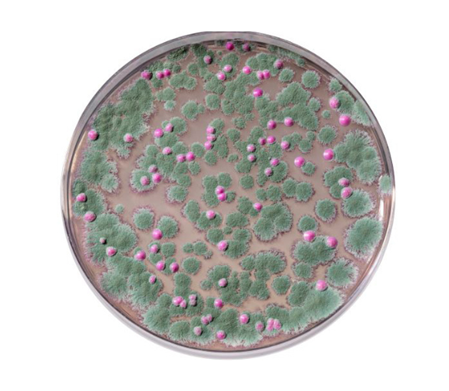 Revolutionising Yeast and Mould Detection with SYMPHONY® Agar - Medical ...